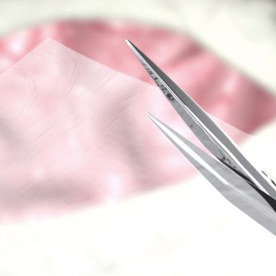 biocade dura - biotrics